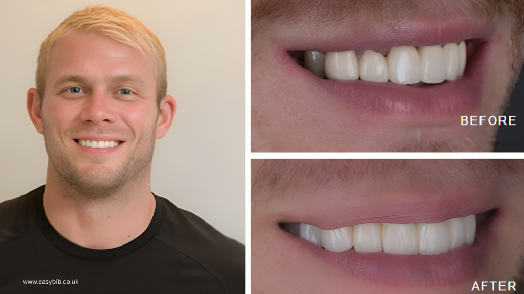 5 High-Tech Fixes That Turn Back Years of Tooth Wear